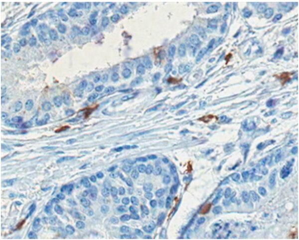 Anti-GD1a Ganglioside Antibody, clone GD1a-1 (Azide Free) | MAB5606Z